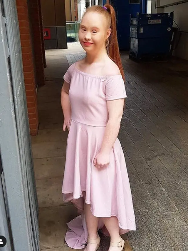 Jatuh Bangun Madeline Stuart, Pengidap Down Syndrome Taklukkan Dunia Modeling - Lifestyle ...