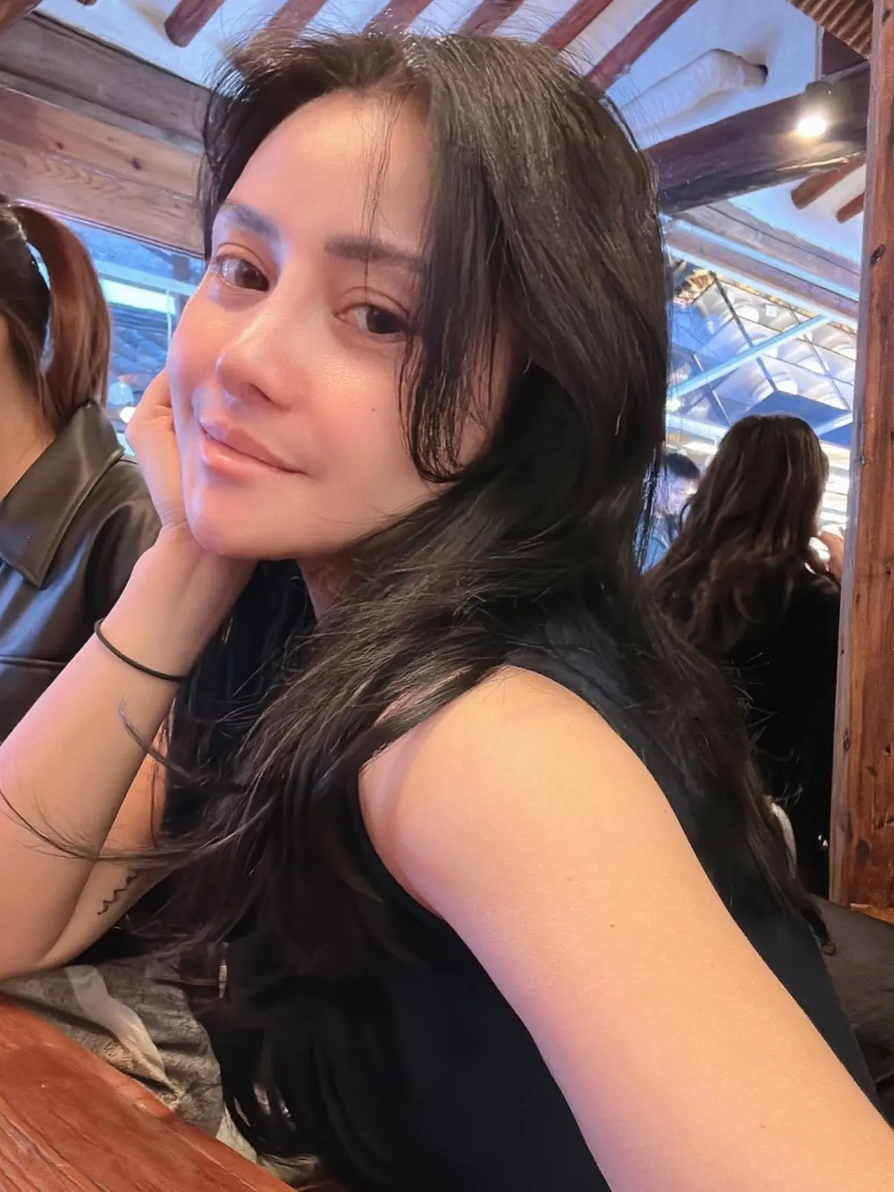 7 Transformasi Mawar AFI Sebelum dan Sesudah Oplas Hidung, Bikin Pangling - Hot Liputan6.com