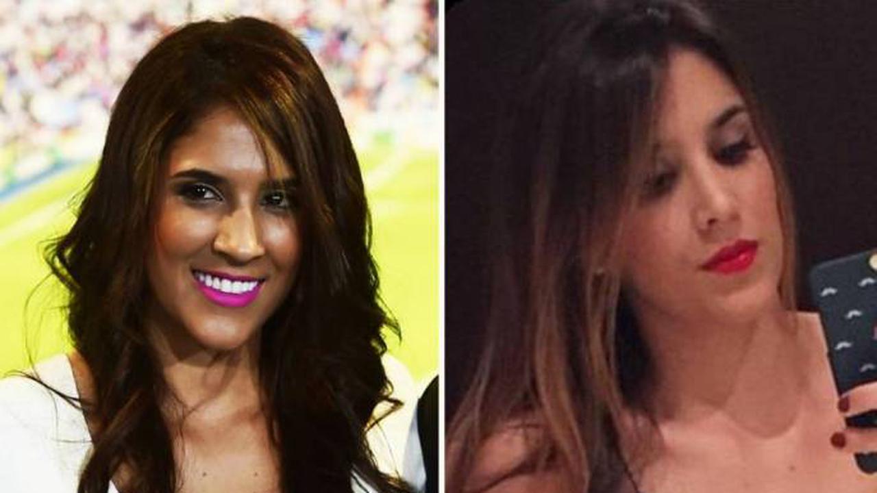 Dihina Buruk Rupa, Istri James Rodriguez Langsung Operasi Plastik