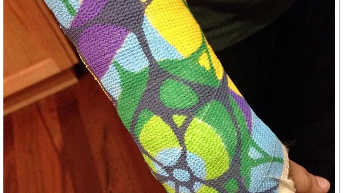 Karya Seni Unik dari Perban Tangan dan Kaki - Global Liputan6.com