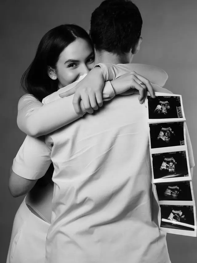 6 Potret Steffi Zamora Umumkan Hamil Anak Nino Fernandez, Unggah Foto ...