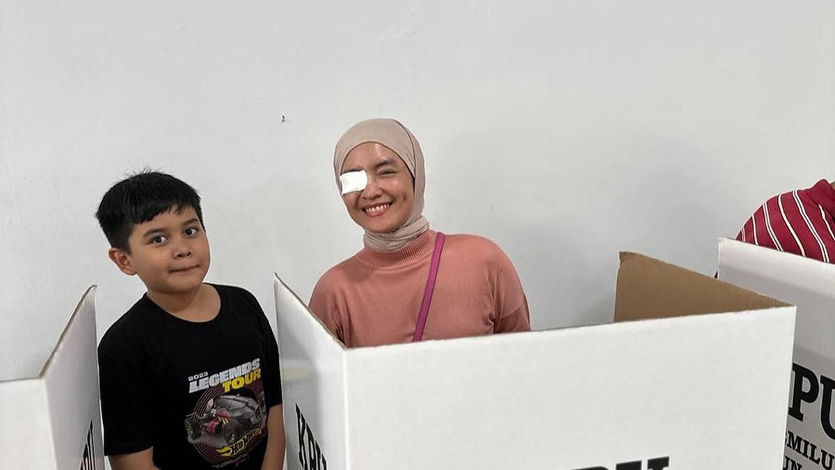 Gara-Gara Kornea Terkelupas, Mata Kanan Intan Nuraini Diperban Seminggu - Entertainment Fimela.com