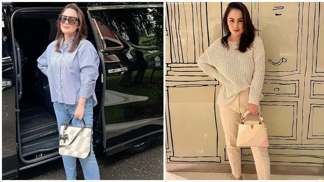 6 Potret Beda Penampilan Jennifer Dunn Sebelum dan Setelah Operasi ...