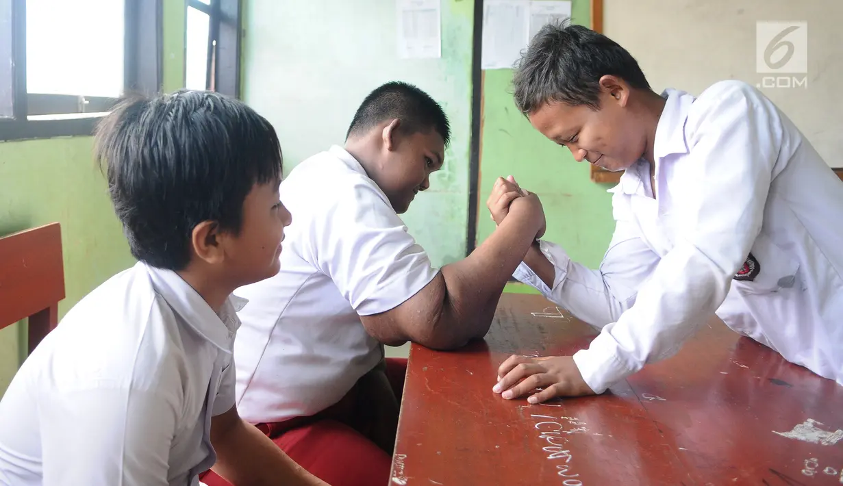 FOTO: Turun 105 Kilogram, Begini Penampakan Arya Permana Sekarang ...