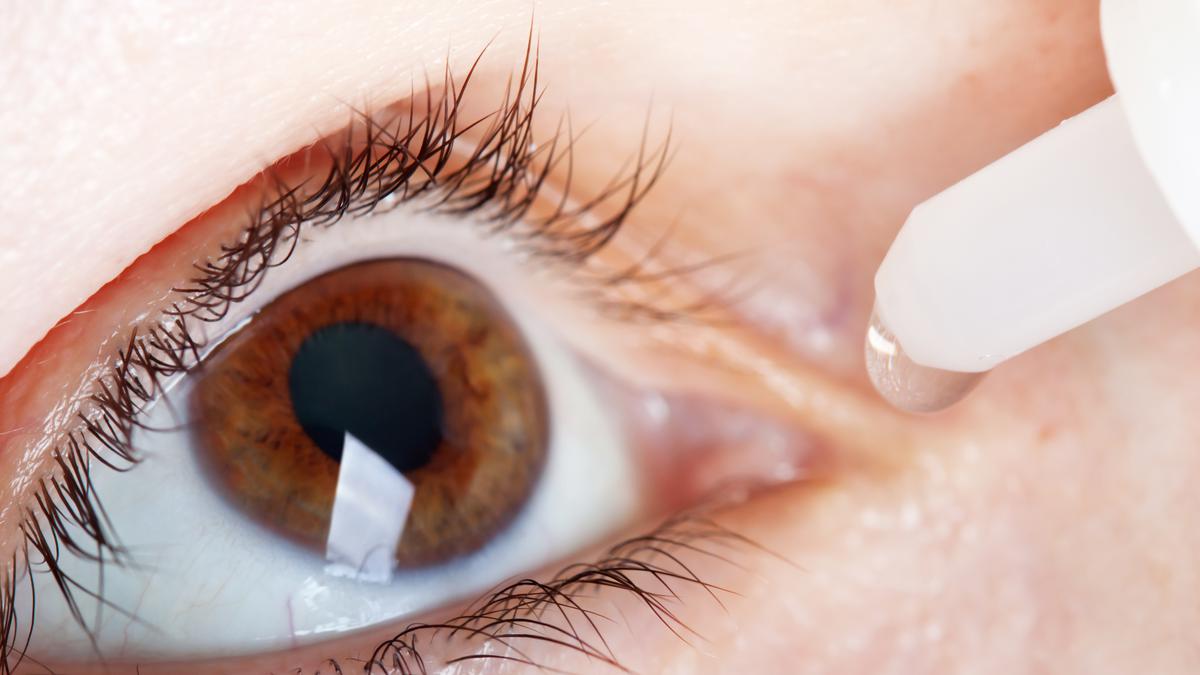 Agar Tak Kering, Coba Pelembab Mata - Health Liputan6.com