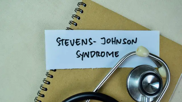 Ketahui Penyebab, Gejala, dan Penanganan Stevens-Johnson Syndrome (SJS ...