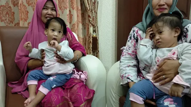 Kondisi Terkini Bayi Kembar Siam Kendari, Azila Rela Hidup Tanpa Otot Perut demi Aqila ...