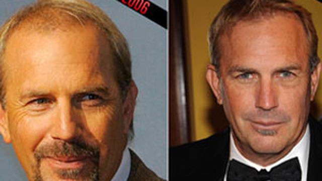 5 Selebriti Tampan yang Punya Masalah Kebotakan - Health Liputan6.com