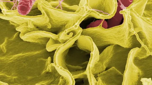 Contoh-Contoh Kingdom Monera dan Penjelasannya - Ragam Bola.com