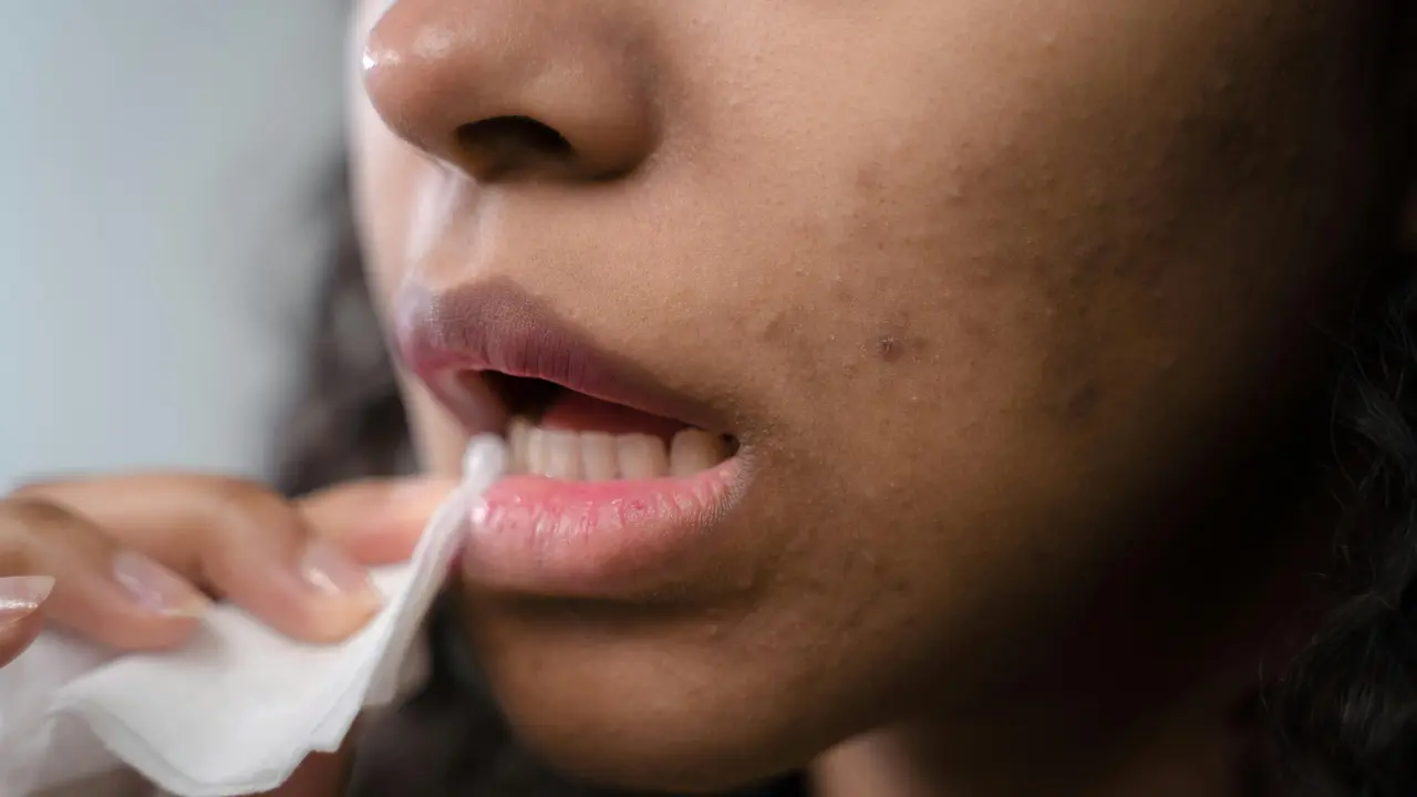 5 Cara Membuat Bibir tetap Lembut, Sehat, dan Natural Plumpy - Beauty Fimela.com