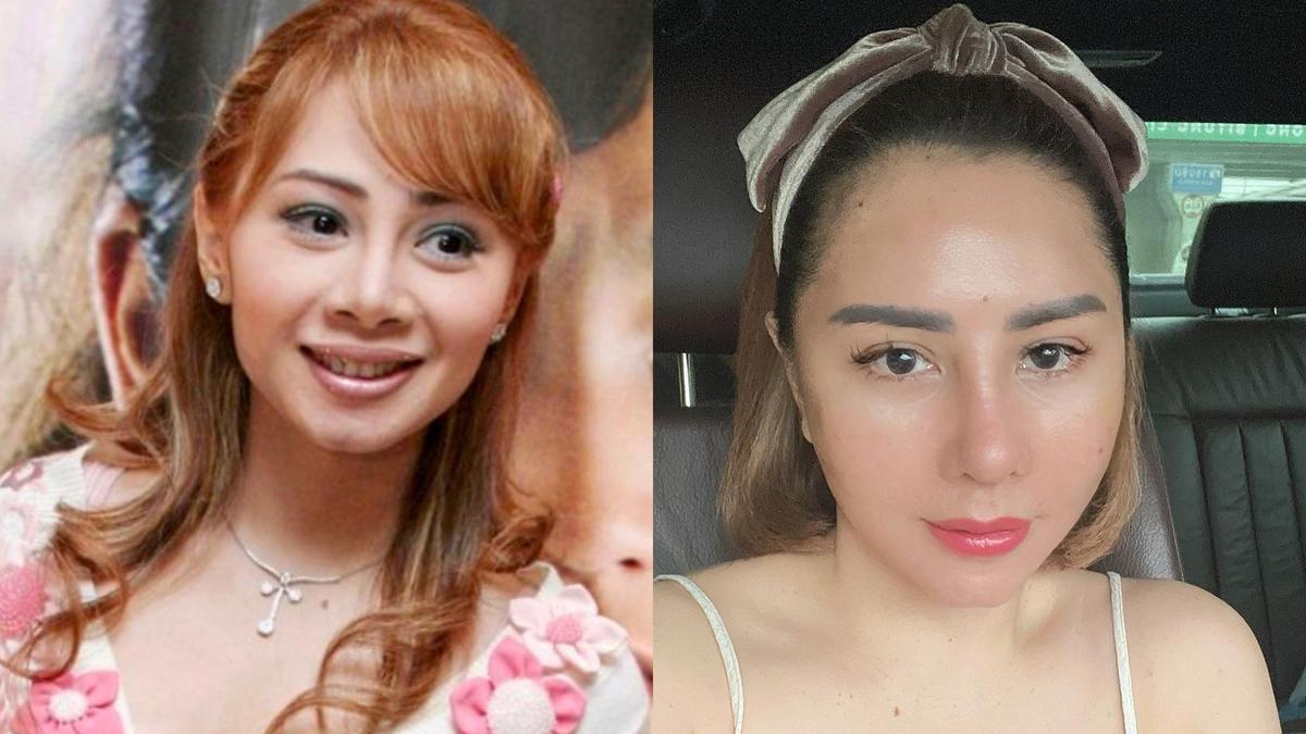Transformasi Femmy Permatasari dari Dulu hingga Baru Selesai Operasi Plastik di Korea - Foto ...