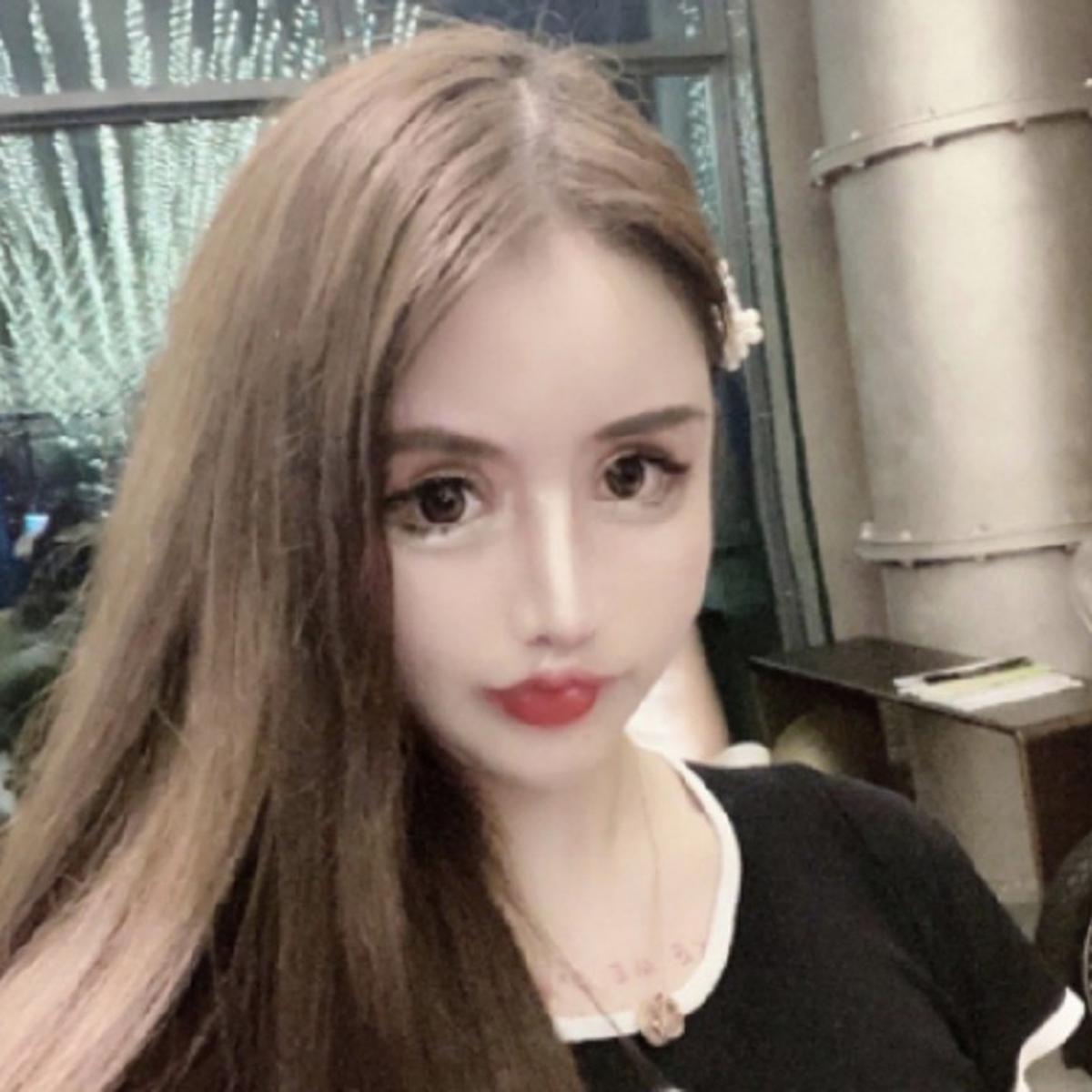 Foto Manusia Barbie Sebelum Operasi