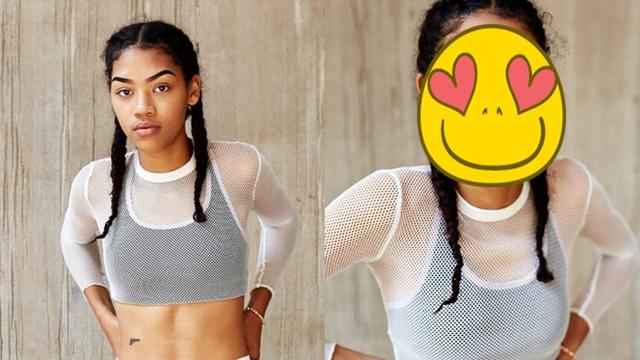 Punya Gigi Ompong, Gadis Ini Sukses Jadi Sosok Tak Terduga - Hot ...