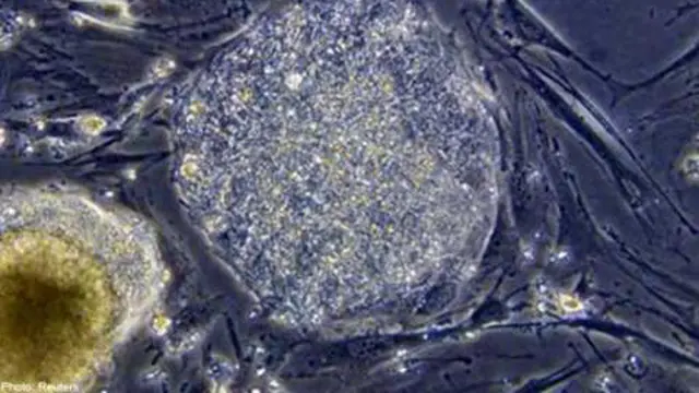 Oogenesis Adalah Proses Pembentukan Sel Telur, Ini Tahapannya - Hot ...