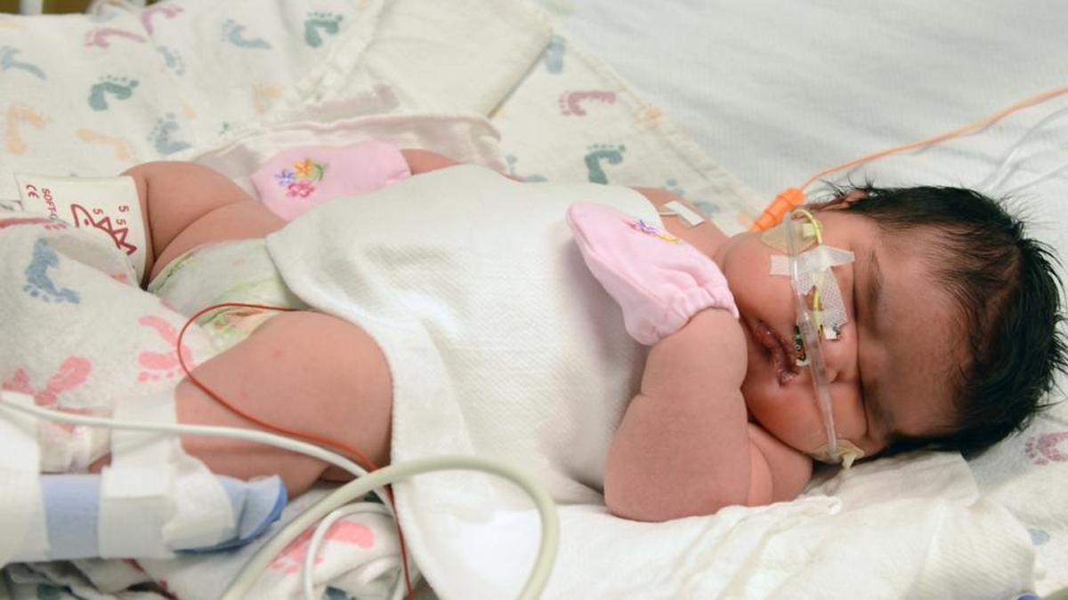 Bayi Ini Lahir dengan Berat Hampir 6 Kilogram