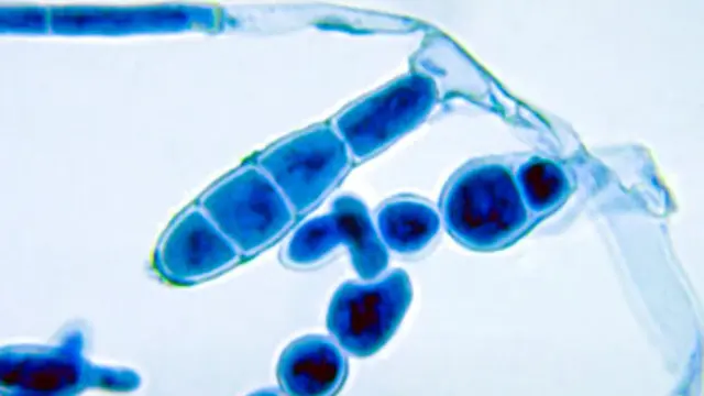 Cara Mencegah dan Mengobati Jamur Ringworm - Health Liputan6.com