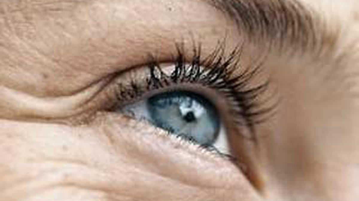 Deteksi Penyakit Jantung Lewat Kelopak Mata - Health Liputan6.com