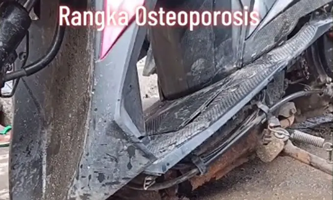 Viral Video Rangka Vario dan Beat Korosi hingga Patah, Kini Honda ...