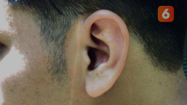 Hari Pendengaran Sedunia, Dokter Imbau Hindari Kebiasaan Mengorek ...