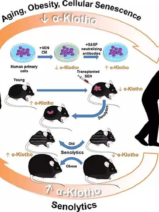 Ilmuwan Kembangkan Obat Pembunuh 'Sel Zombie' pada Manusia, Bisa ...