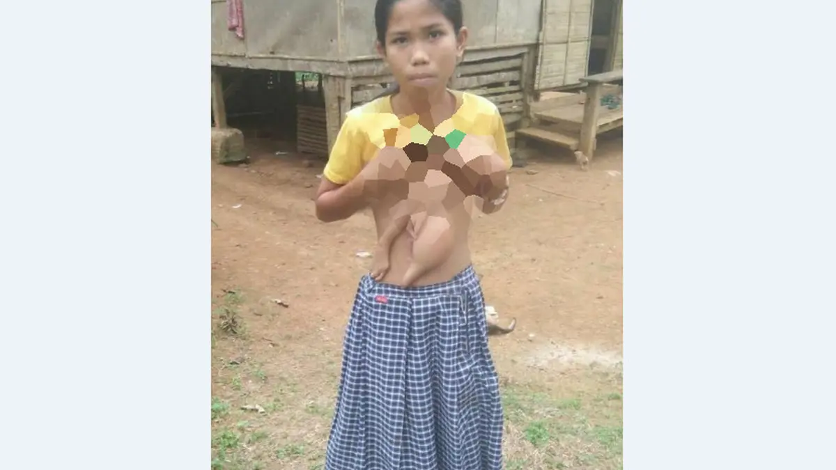 Berita kembar parasit Hari Ini - Kabar Terbaru Terkini | Liputan6.com