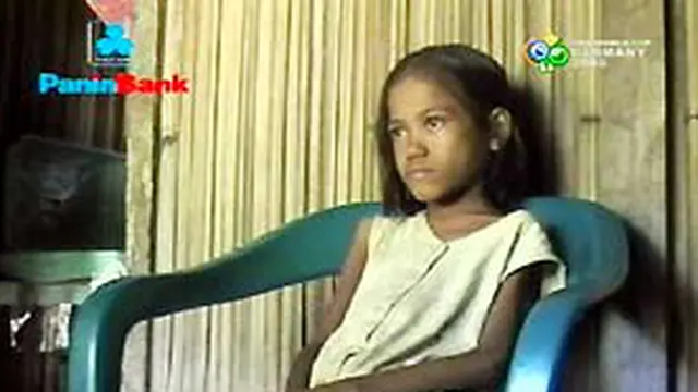 Kekurangan Biaya, Penderita Busung Lapar Menghentikan Pengobatan - News ...