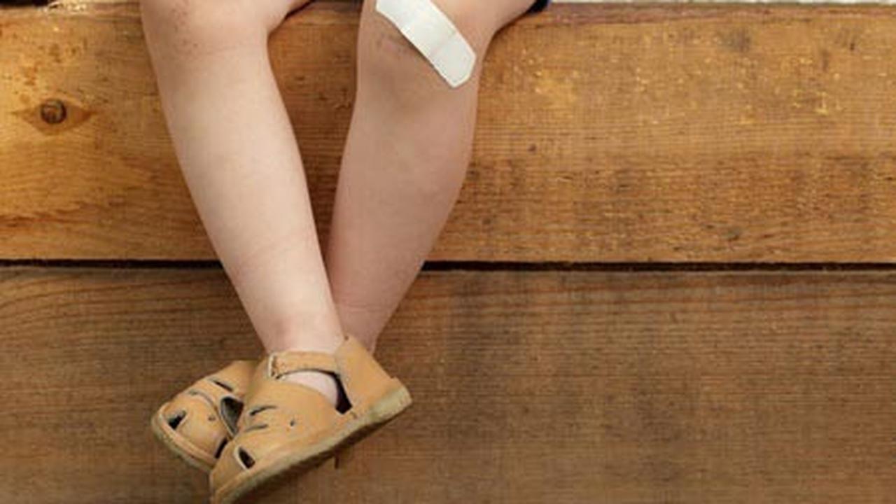 Luka Lecet Terlihat Ringan tapi Bisa Infeksi, Ini Cara Mengobatinya ...