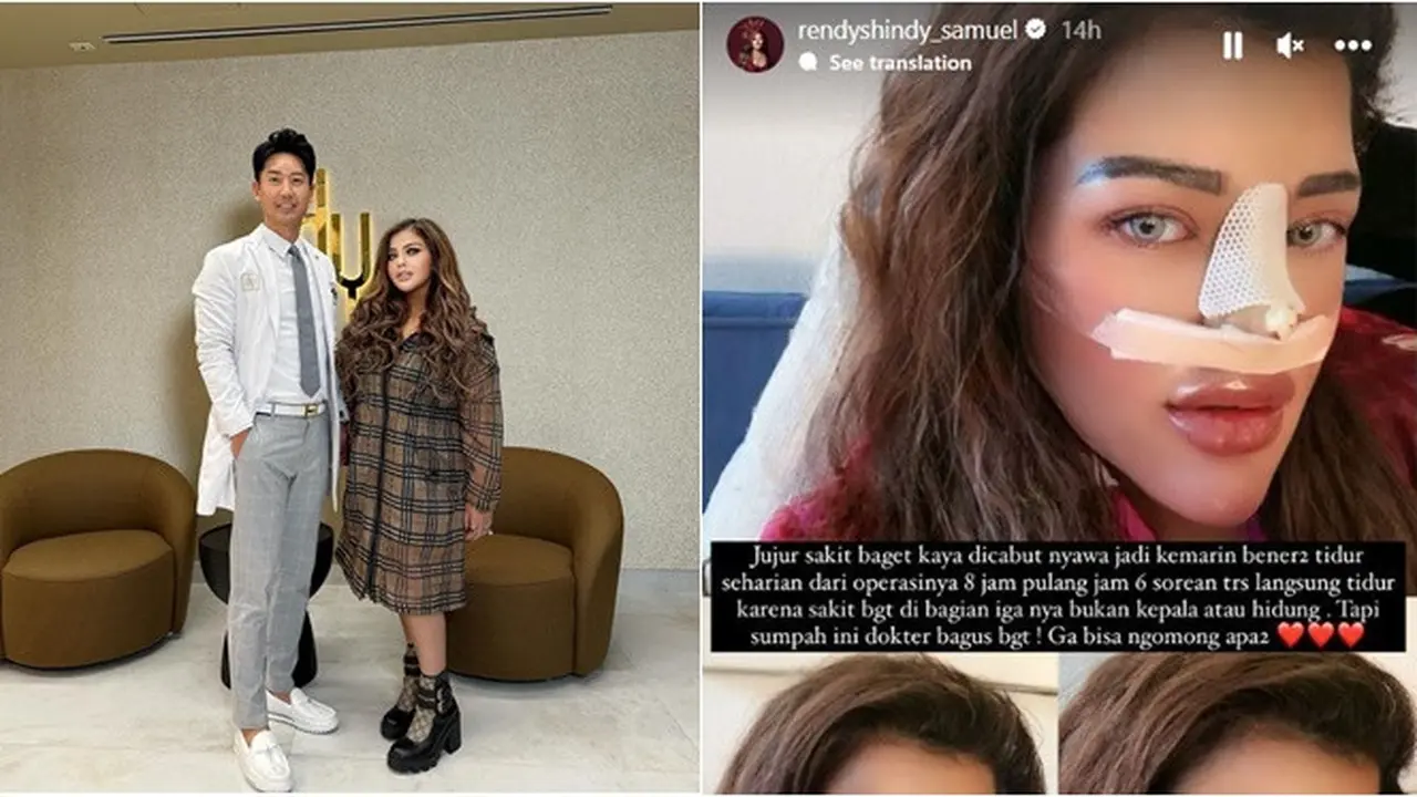 Setelah Operasi Bariatrik, Ini 6 Potret Shindy Samuel yang Kini Jajal Oplas Hidung - Hot ...