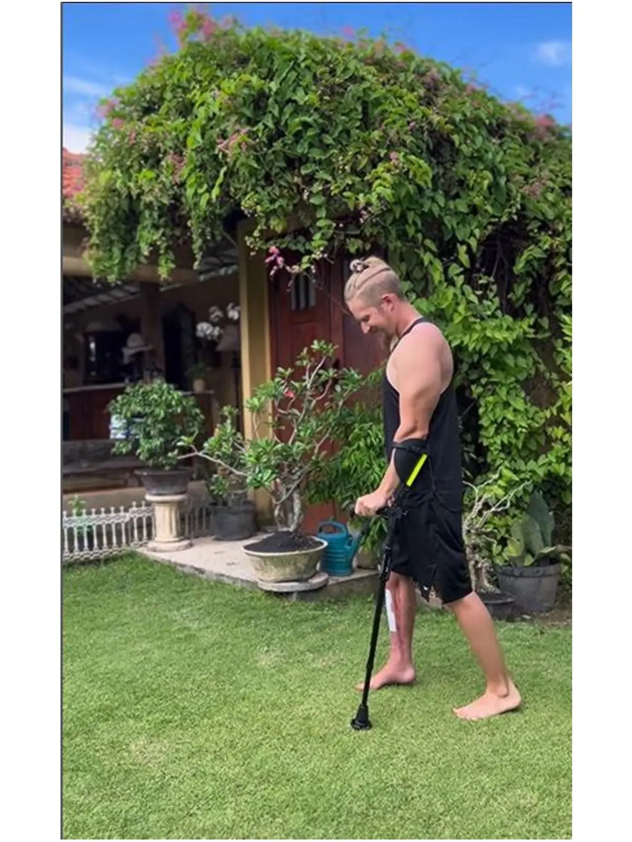 6 Potret Terkini Daood Debu Pasca Kecelakaan dan 5 Kali Operasi, Sudah Bisa Jalan - Hot Liputan6.com