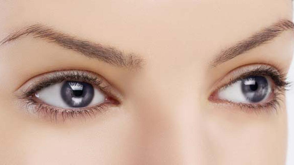 Bagaimana Cara Mengatasi Kantung Mata yang Mengganggu Penampilan Anda?