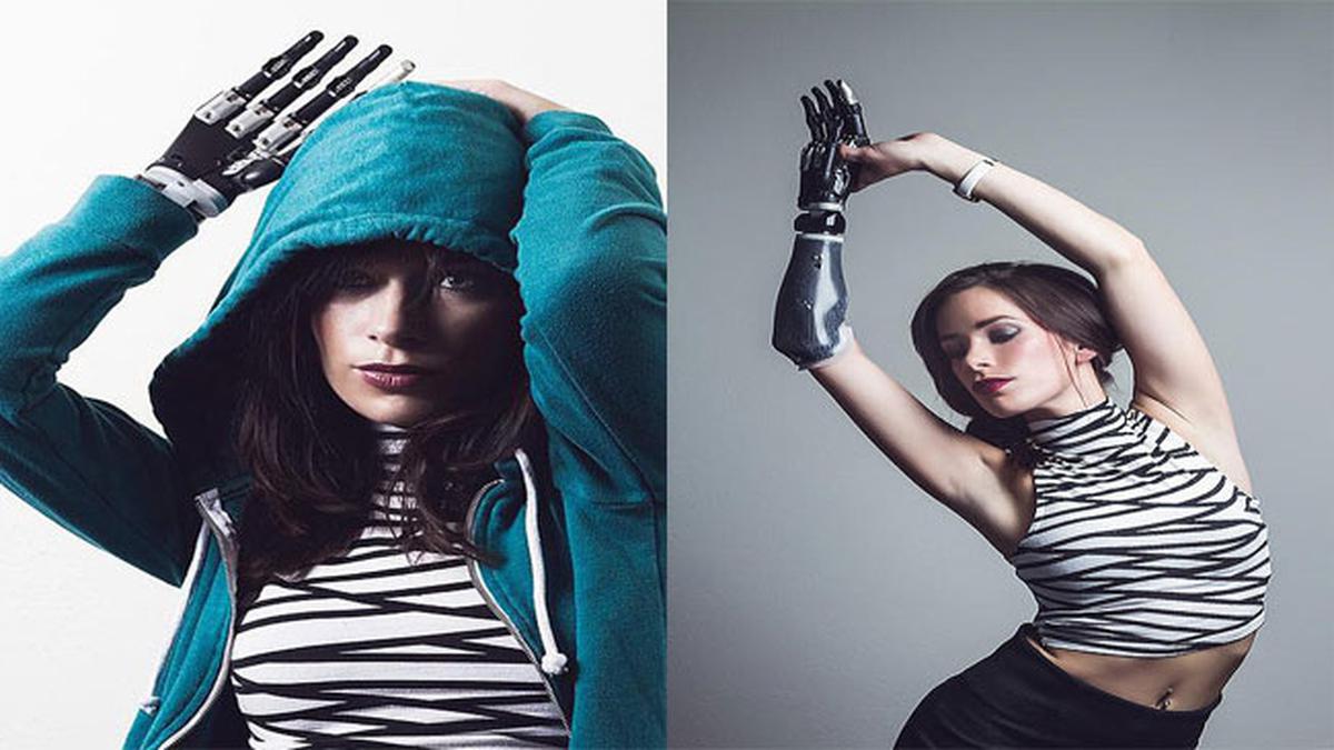 Model dengan Lengan Bionik Akan Tampil di New York Fashion Week ...