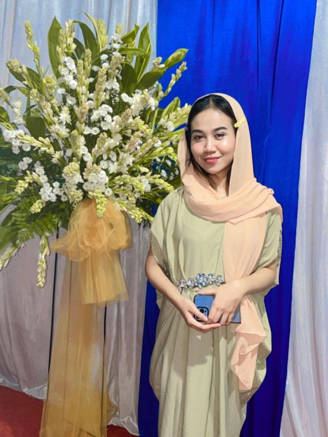 8 Potret Perubahan Wajah Mayang Usai Operasi Hidung, Sudah Lepas Perban