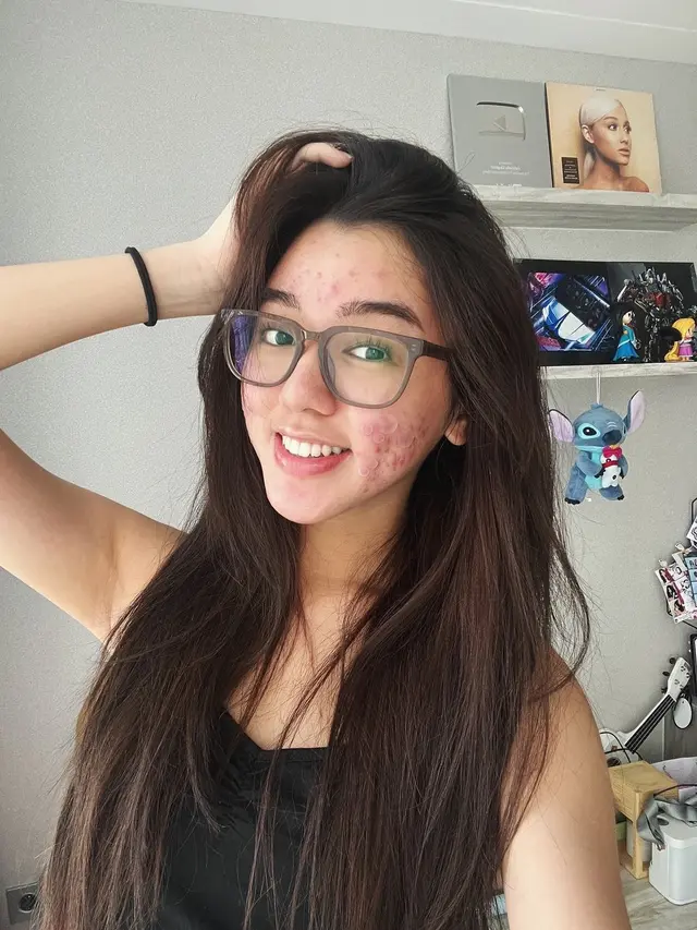 Potret Menawan Gabriella Eka Putri, Tampil Percaya Diri dengan Bare Face dan Berjerawat - Beauty ...