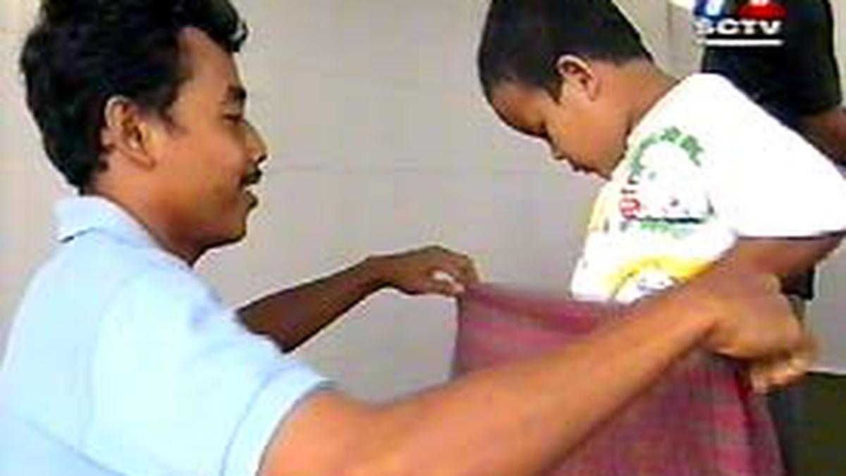 Kesabaran Lebih untuk Anak-anak Cacat Ganda - News Liputan6.com