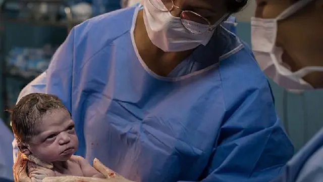 Pasang Wajah Cemberut Saat Lahir, Ekspresi Bayi Ini Bikin Gemas ...