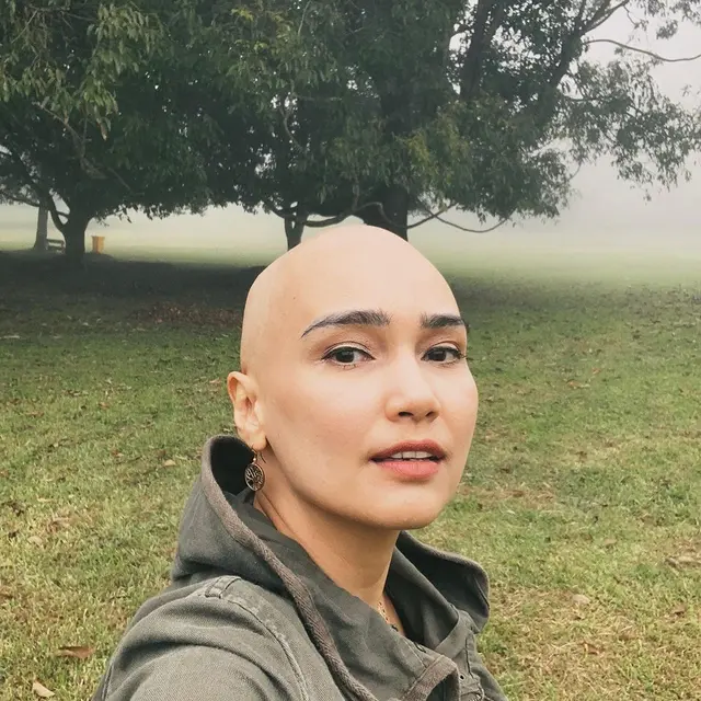 5 Fakta Feby Febiola Dinyatakan Sembuh dari Kanker Ovarium - ShowBiz ...