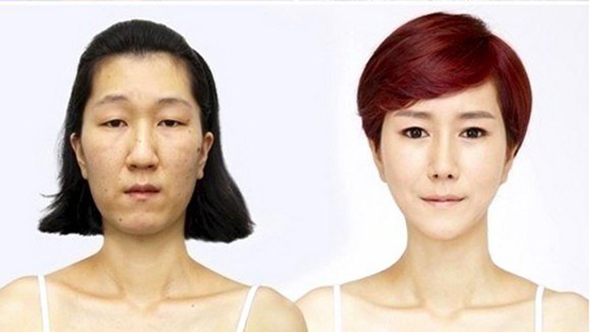 Akhiri Depresi, Wanita Ini Punya Wajah Baru - Lifestyle Liputan6.com