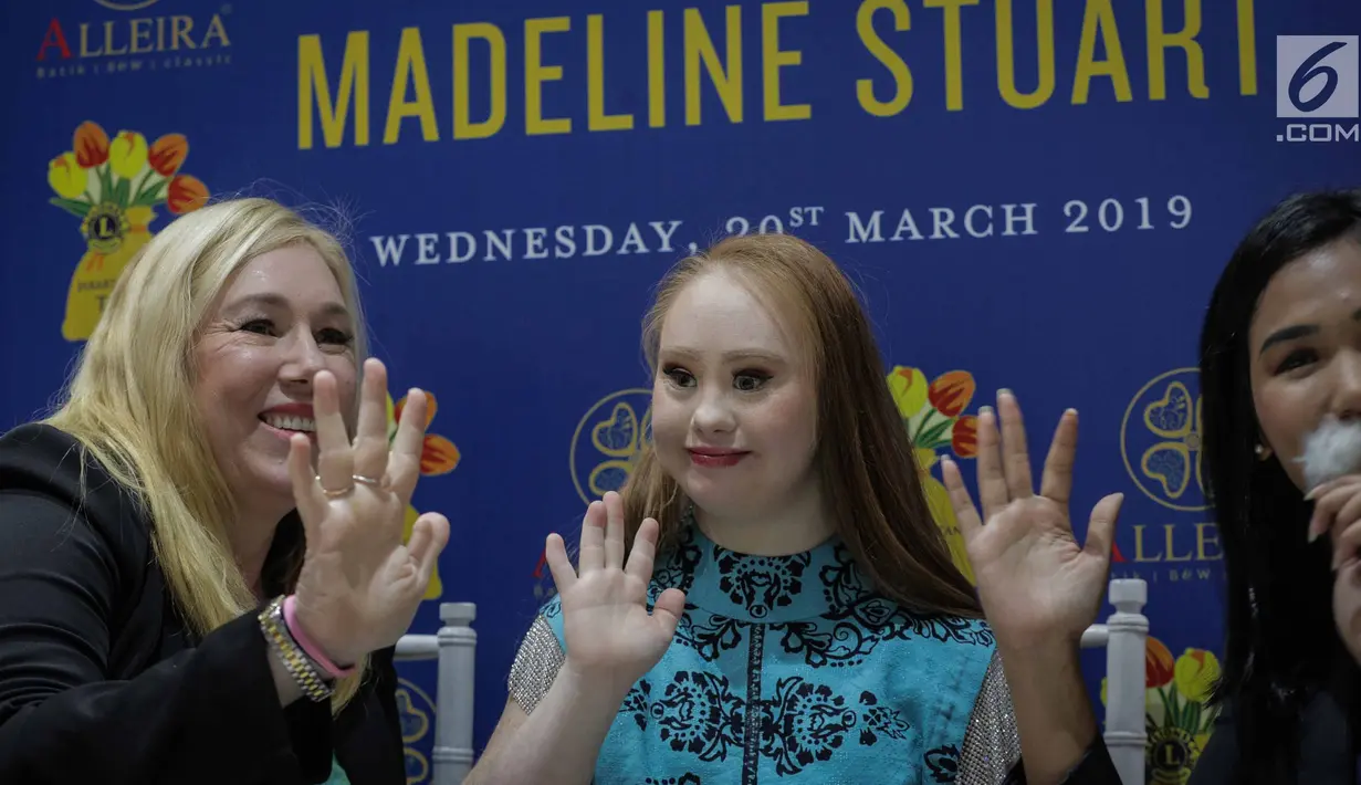 FOTO: Mengenal Madeline Stuart, Model Down Syndrome Asal Australia - Foto Liputan6.com