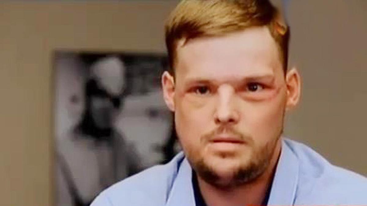 VIDEO: Andy Sandness, Pasien yang Sukses Miliki Wajah Baru - TV ...