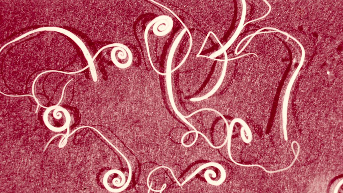 Waspadai 4 Jenis Cacing Penyebab Cacingan - Health Liputan6.com