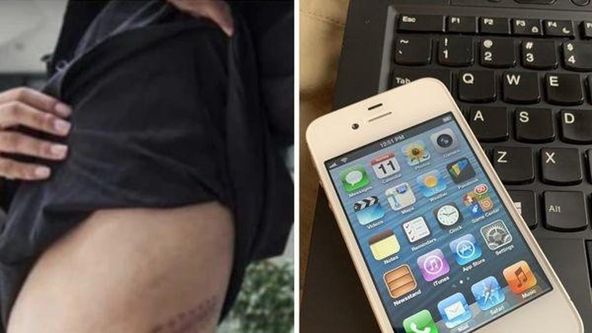 Kisah Remaja Rela Jual Ginjal Demi Beli Iphone Ini Bikin Pilu Hot Liputan Com