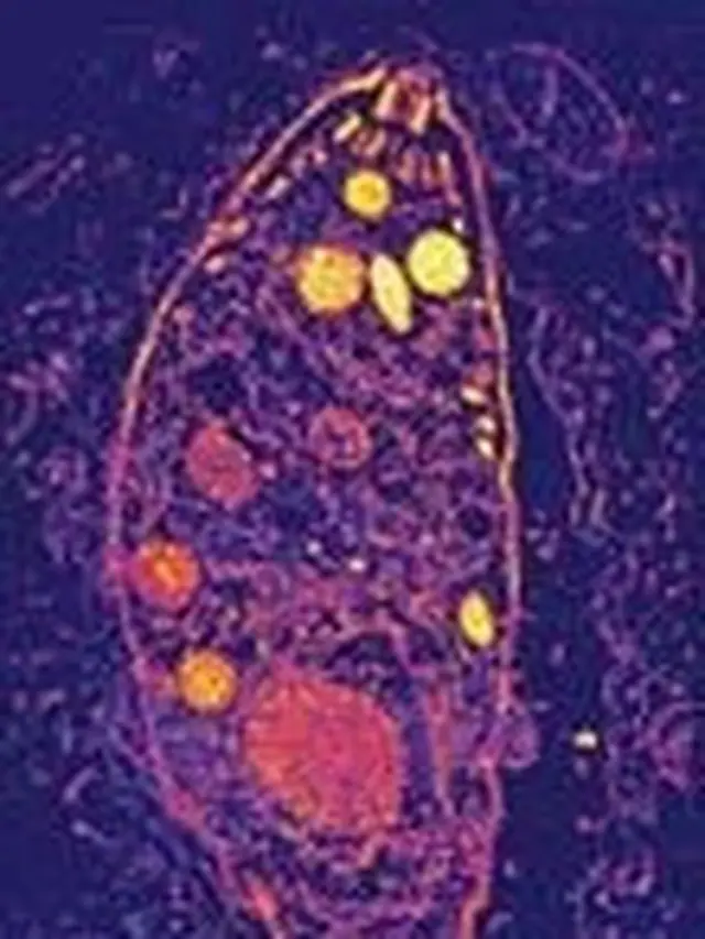 Ilmuwan Ungkap Parasit Kucing Bisa Ubah Perilaku Manusia, Bisa Bikin ...