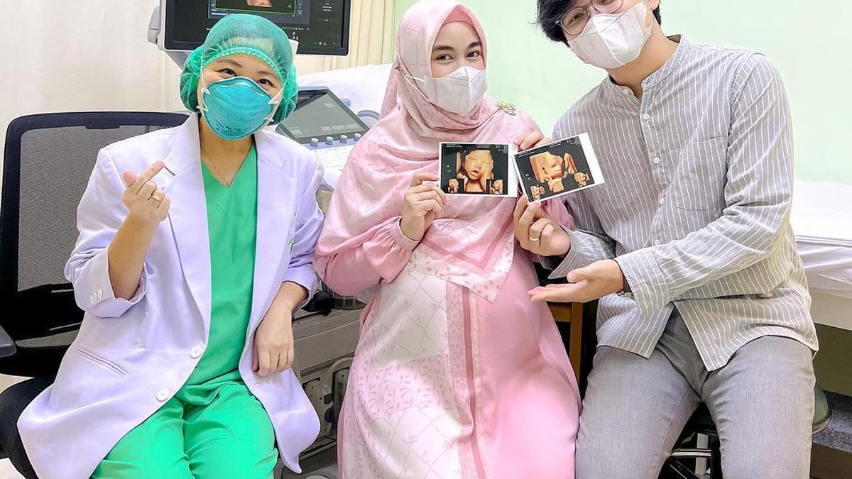 Anisa Chibi Instagram Terbaru