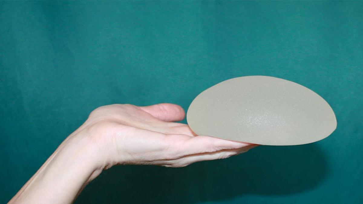 Mau Pakai Silikon? Pilih yang Bisa Bersahabat dengan Tubuh - Health ...