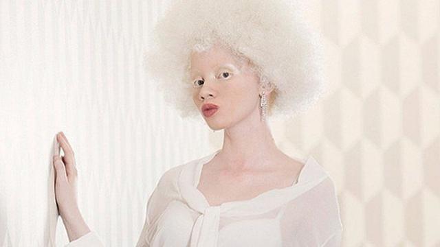 Thando Hopa, Model yang Albino pun Mendunia Seperti Diop - Citizen6 ...