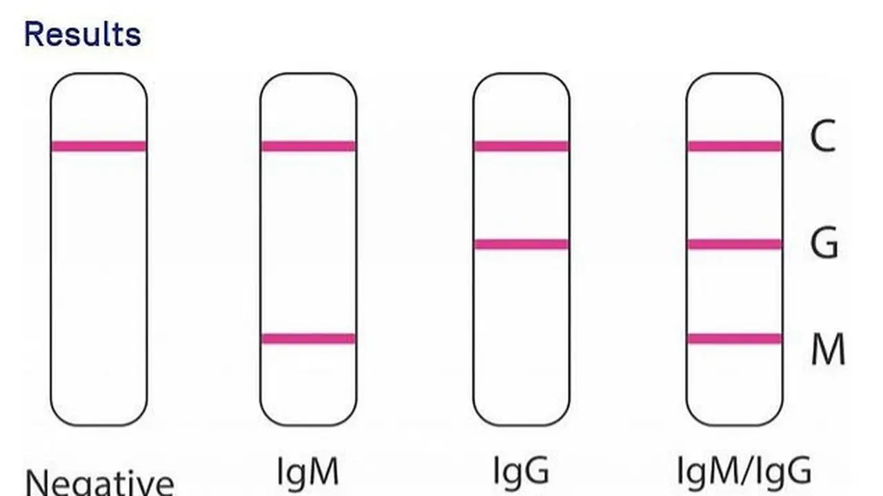 Pahami Makna Hasil Rapid Test, Ini Penjelasannya - Health Liputan6.com