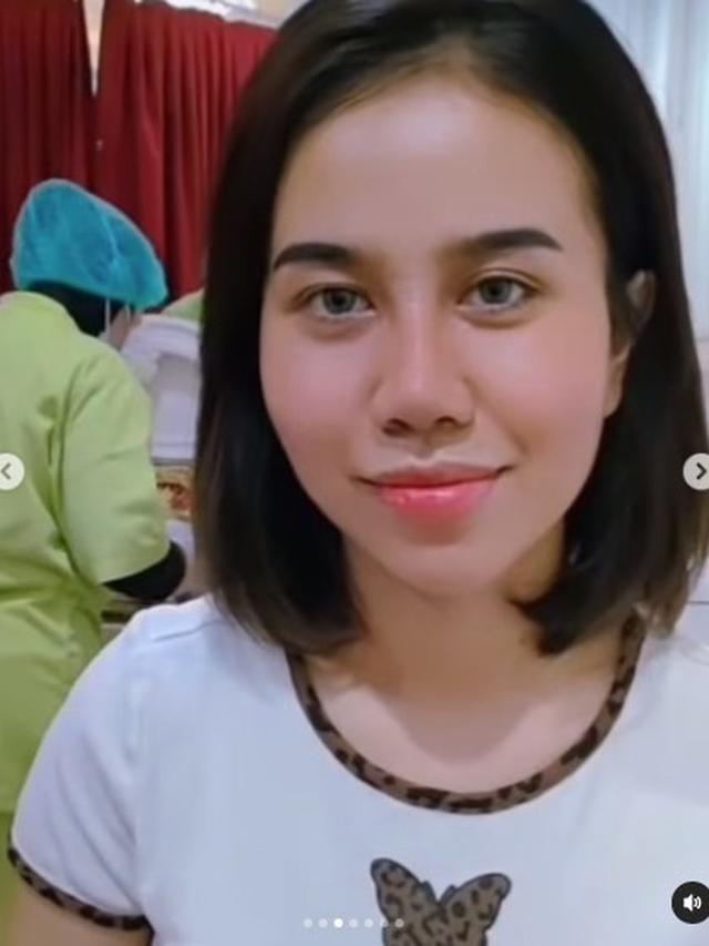 8 Potret Perubahan Wajah Mayang Usai Operasi Hidung, Sudah Lepas Perban