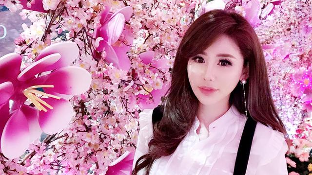 Karier Hancur, Penyanyi Dyna Fransisca Lakukan Operasi Plastik ...