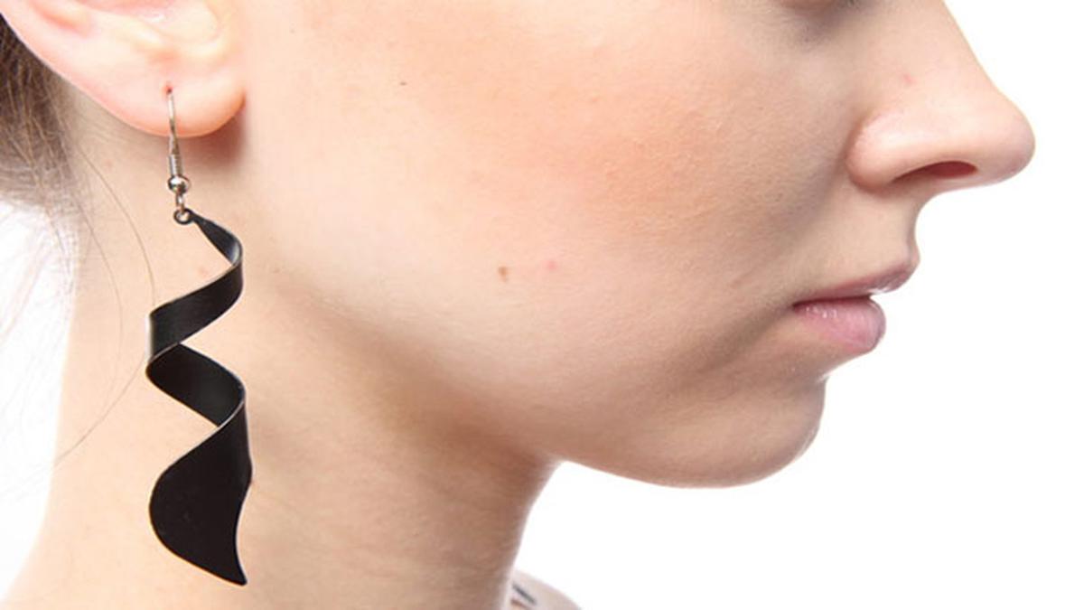 Operasi Kuping Sedang Populer di Kalangan Perempuan - Health Liputan6.com