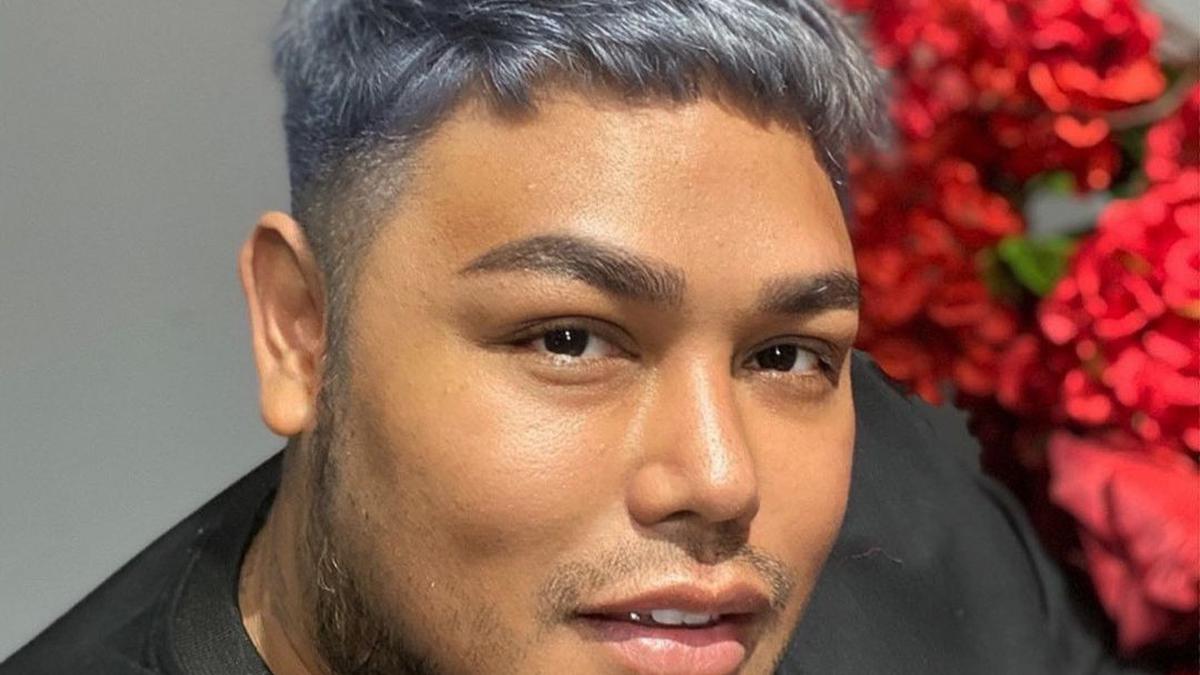 Bagian Wajah Ivan Gunawan Hasil Operasi Plastik, Habiskan Biaya Rp 1 Miliar